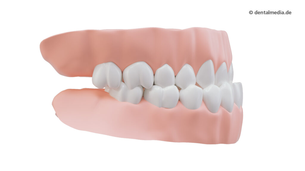 Kieferorthopädie — KFO Forster in Regensburg & Lappersdorf